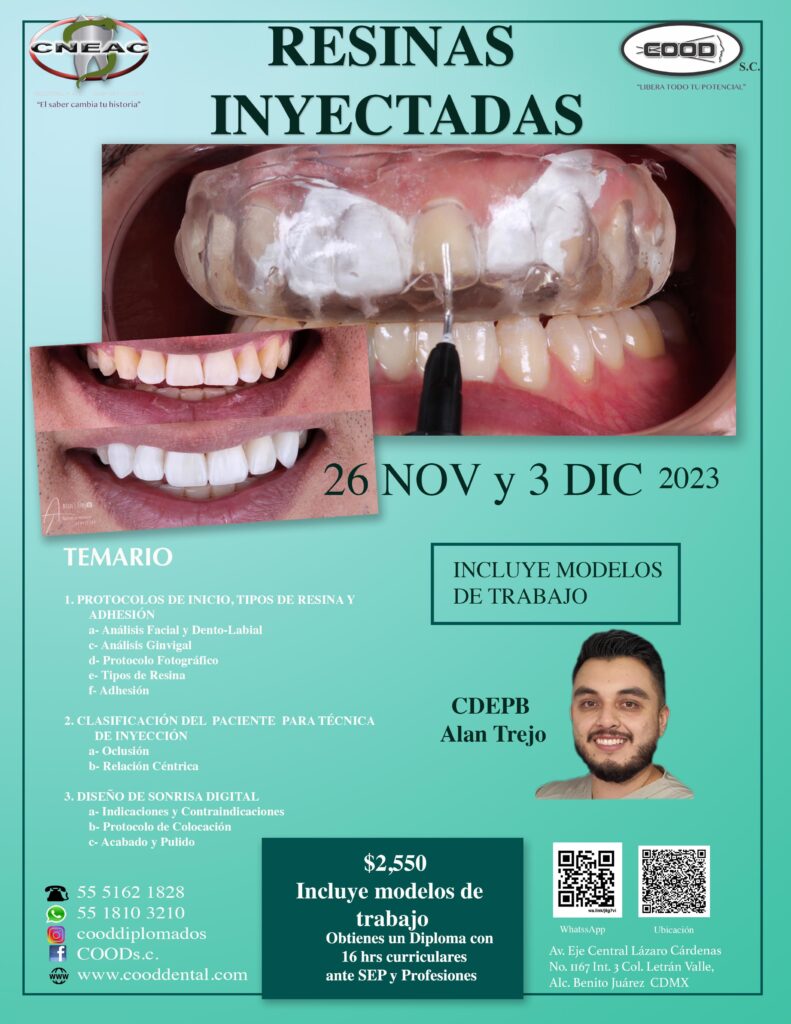 Resinas Inyectadas - Centro en Ortopedia y Ortodoncia Dentoalveolar (COOD)